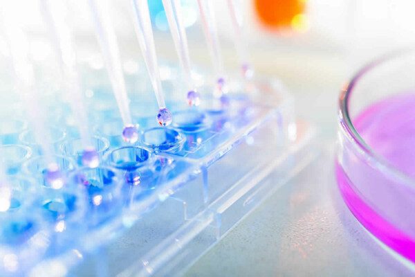 ALS Muscle Twitching vs BFS Muscle Twitching - Target ALS