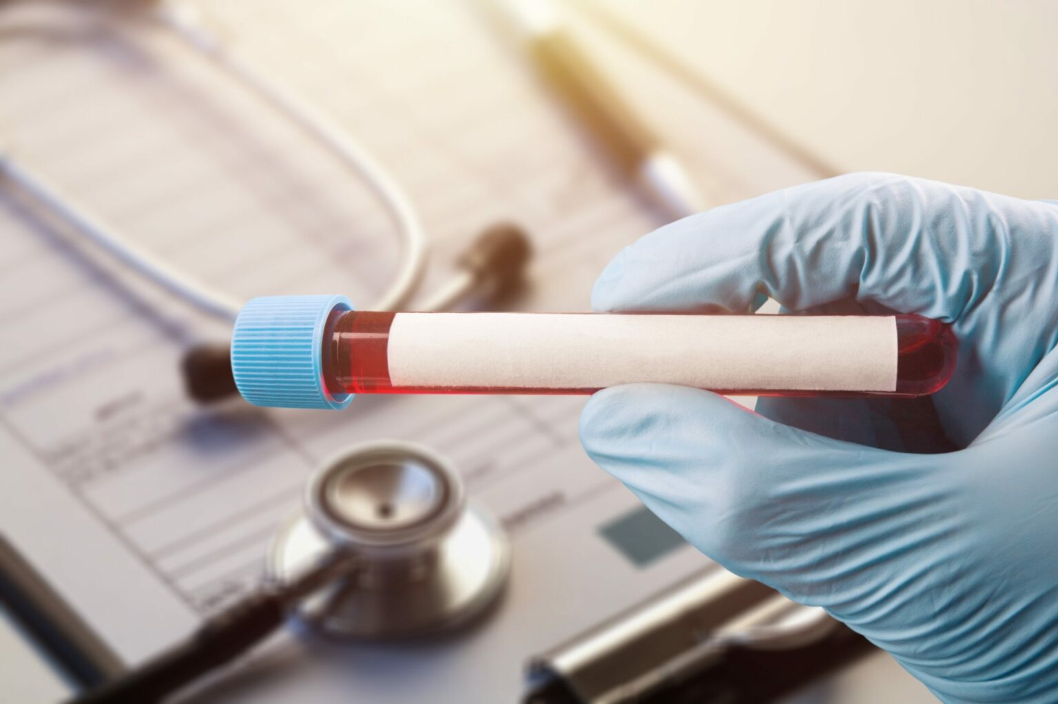 Longitudinal Biofluids Core - Target ALS